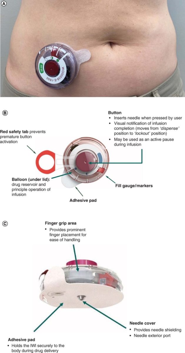 Large-Volume Subcutaneous Delivery | Enable Injections